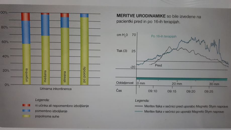 MAGNETO STYM aparat za zdravljenje inkontinence( uhajanje urina )