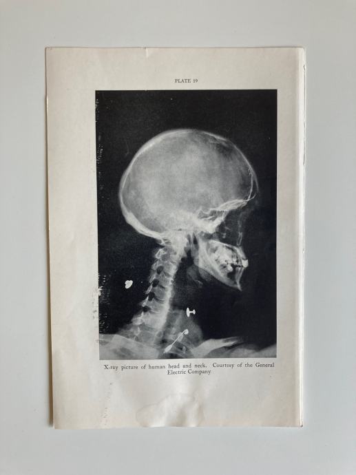 ORIGINAL VINTAGE rentgen lobanje print